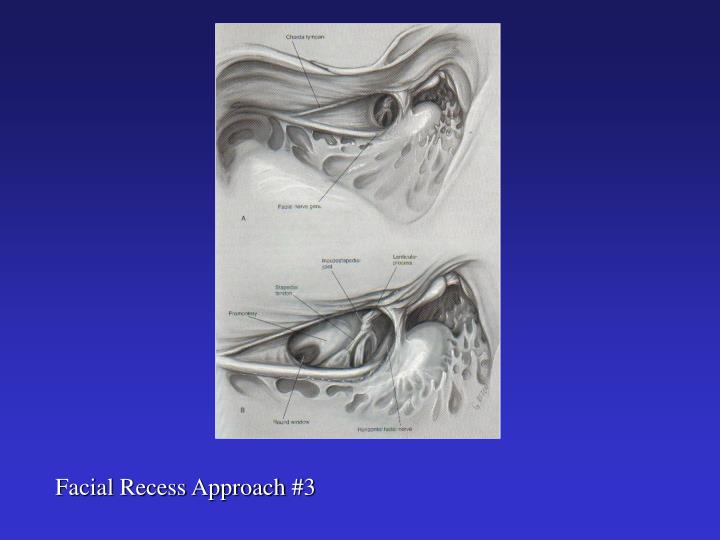 PPT - Cortical Mastoidectomy and Combined Approach Tympanoplasty (CAT ...