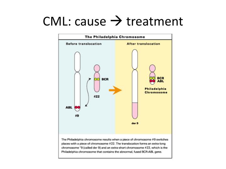PPT - “I’ve been diagnosed with CML. What’s the best initial treatment ...