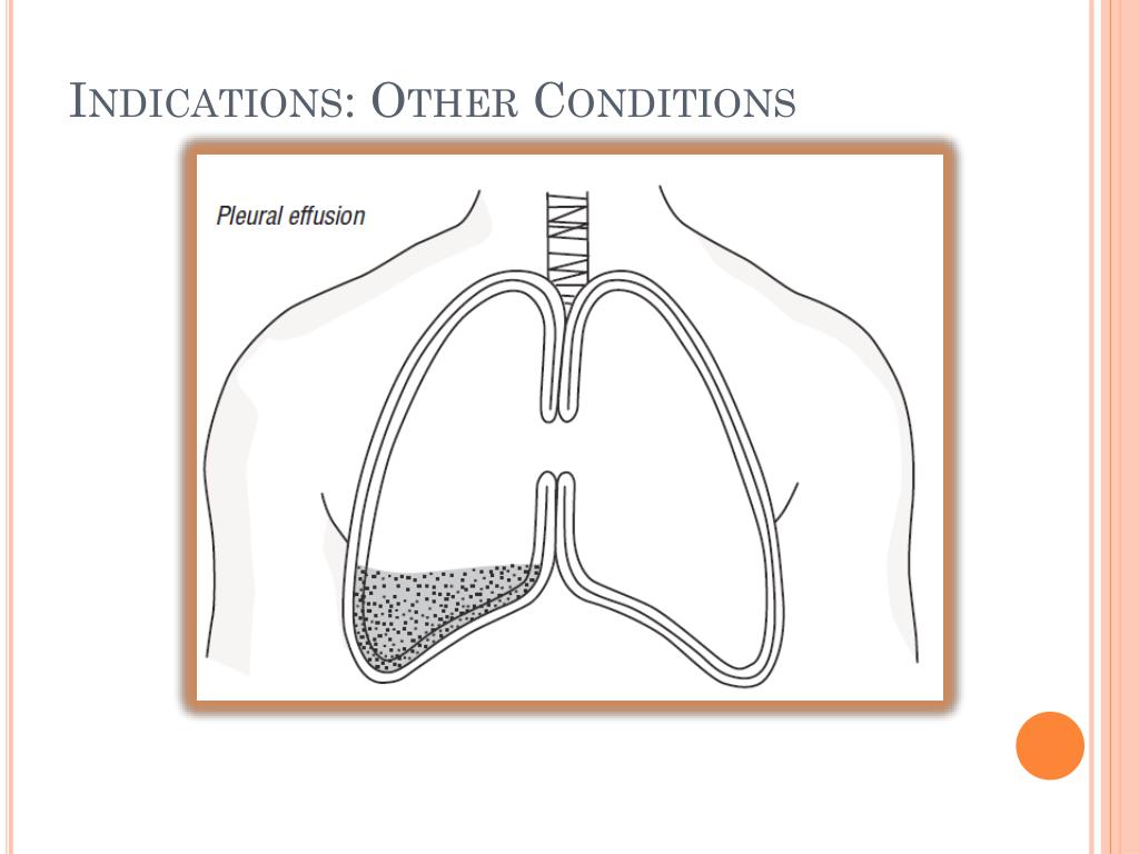 PPT - CHEST TUBES AND DRAINAGE SYSTEMS NURSING COMPETENCY PowerPoint ...