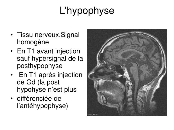 PPT - L'HYPOPHYSE PowerPoint Presentation - ID:6097745