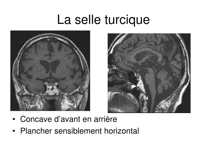 PPT - L'HYPOPHYSE PowerPoint Presentation - ID:6097745