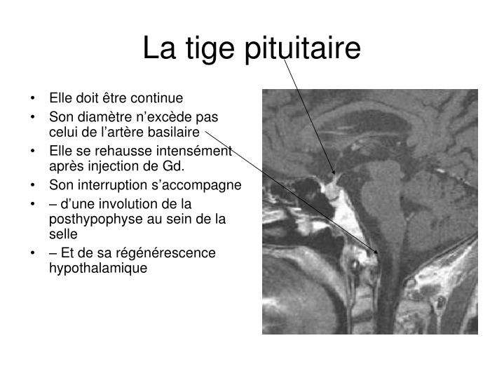 PPT - L'HYPOPHYSE PowerPoint Presentation - ID:6097745