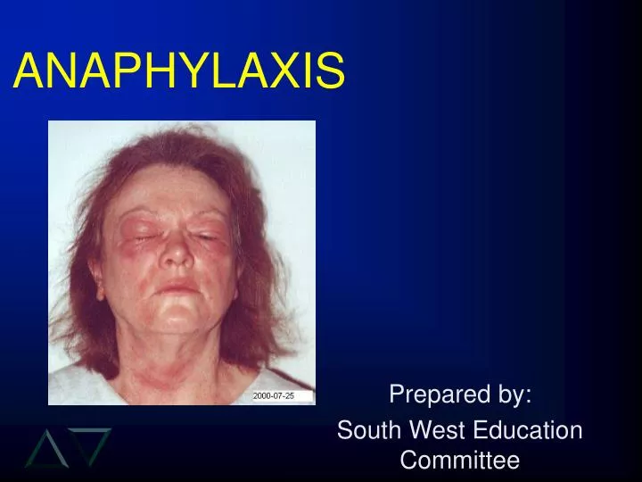 PPT - ANAPHYLAXIS PowerPoint Presentation, free download - ID:6105076