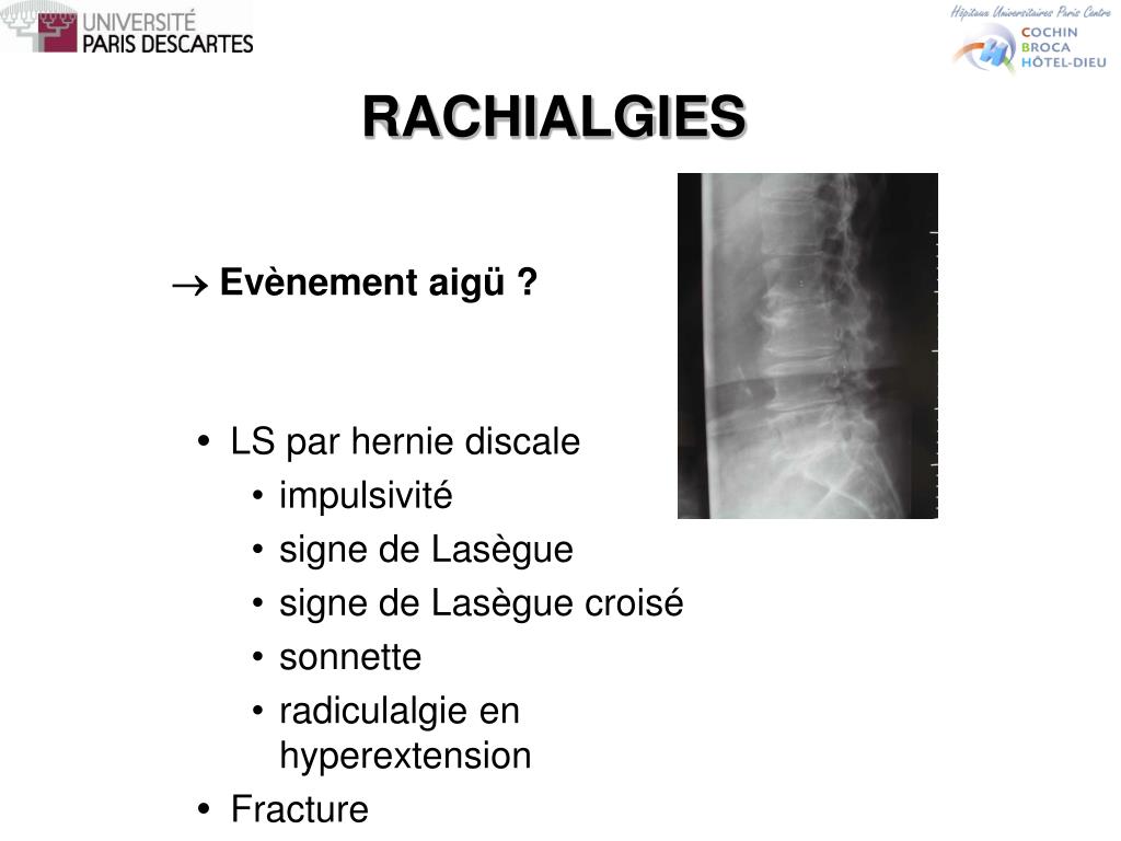 PPT - Séminaires de l’ECN 2012 Rhumatologie PowerPoint Presentation ...