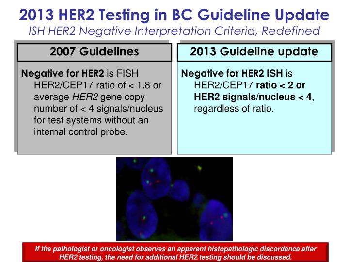 PPT - HER2 Testing in Breast Cancer: 2013 ASCO/CAP HER2 Guideline ...