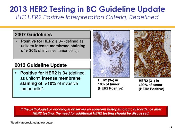 PPT - HER2 Testing in Breast Cancer: 2013 ASCO/CAP HER2 Guideline ...