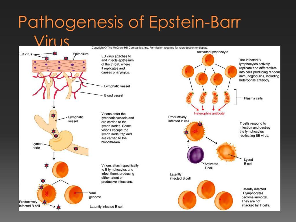 PPT - Blood and Lymphatic Infections PowerPoint Presentation, free ...