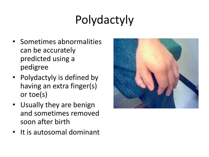 PPT - Interesting Genetic Disorders and Diseases, and Abnormalities ...