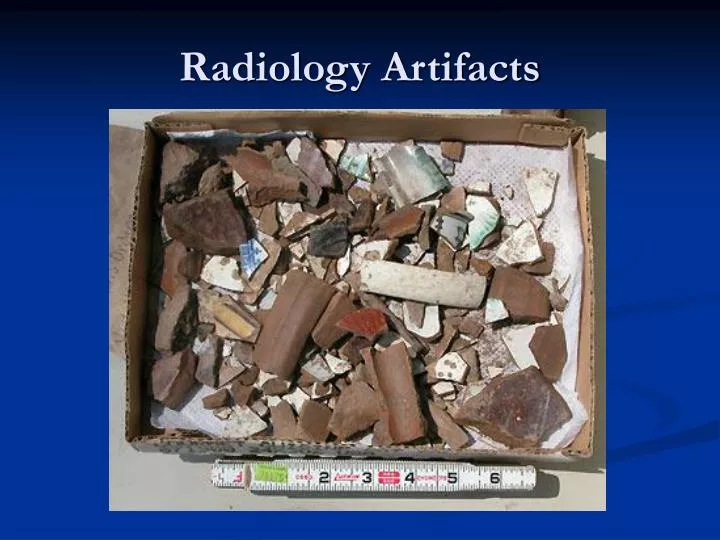 PPT - Radiology Artifacts PowerPoint Presentation, free download - ID ...
