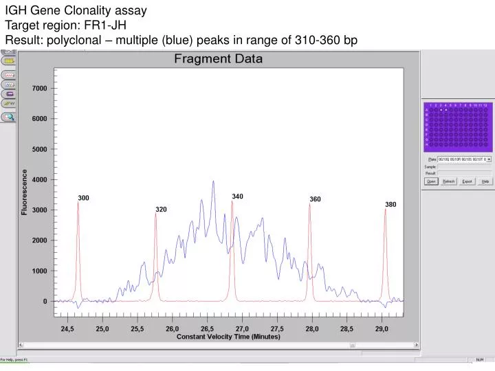 PPT - IGH Gene Clonality assay Target region: FR1-JH PowerPoint ...