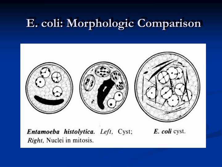 PPT - Entamoeba histolytica E. coli E. gingivalis PowerPoint ...