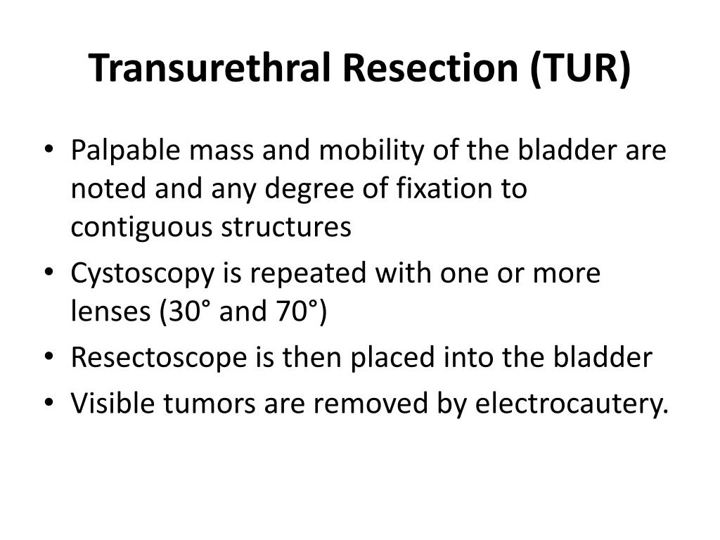 PPT - Urothelial CA: Cancers of the Bladder, Ureter, and Renal Pelvis ...