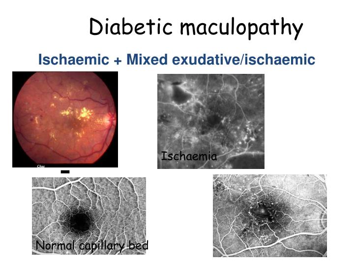 PPT - The Eye in Systemic Diseases PowerPoint Presentation - ID:6122750