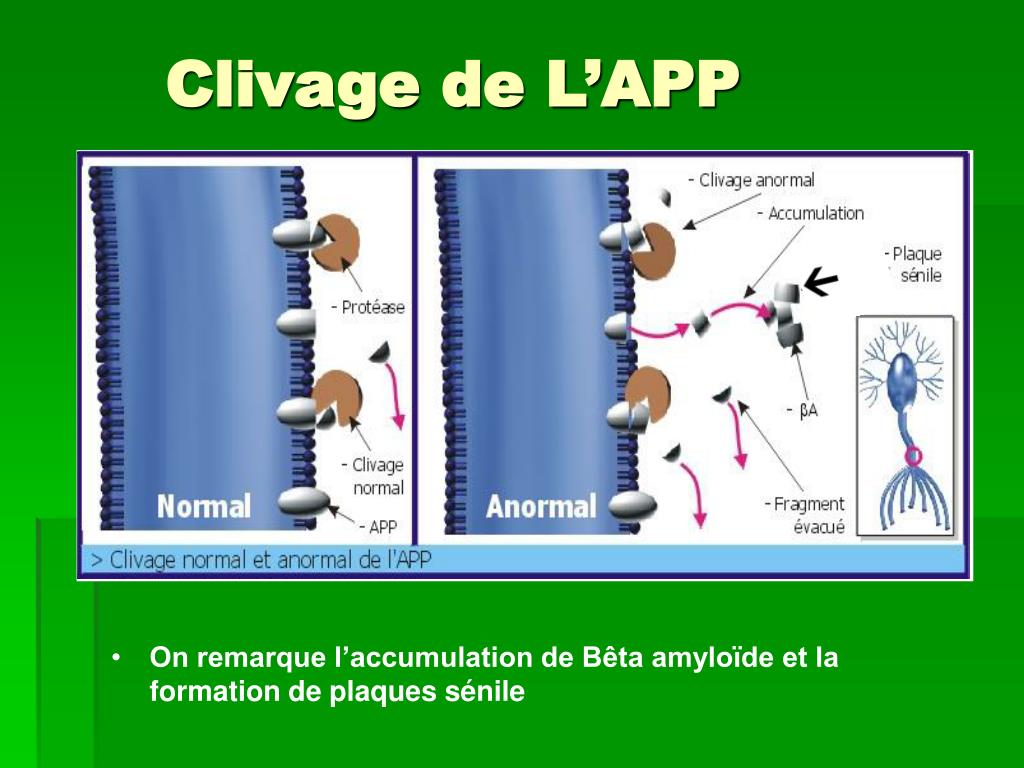 PPT - Alzheimer La Maladie du Futur PowerPoint Presentation, free ...