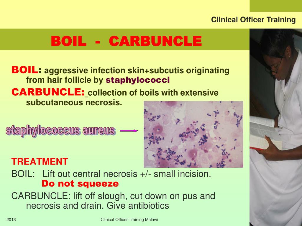 PPT - Clinical Officer Training MALAWI PowerPoint Presentation, free ...