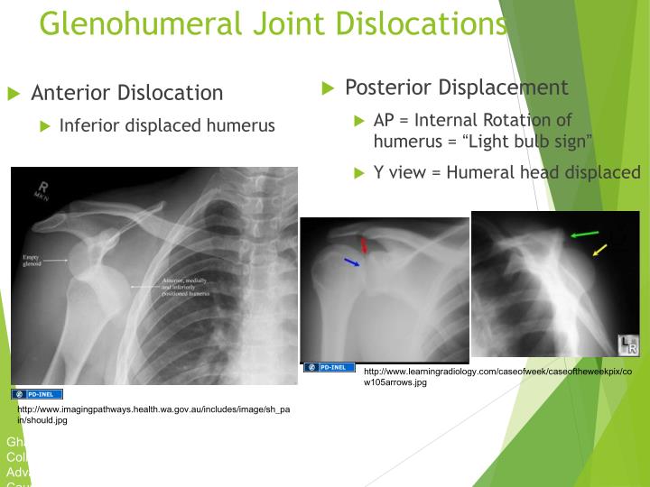 PPT - Orthopedics Injury PowerPoint Presentation - ID:6134100