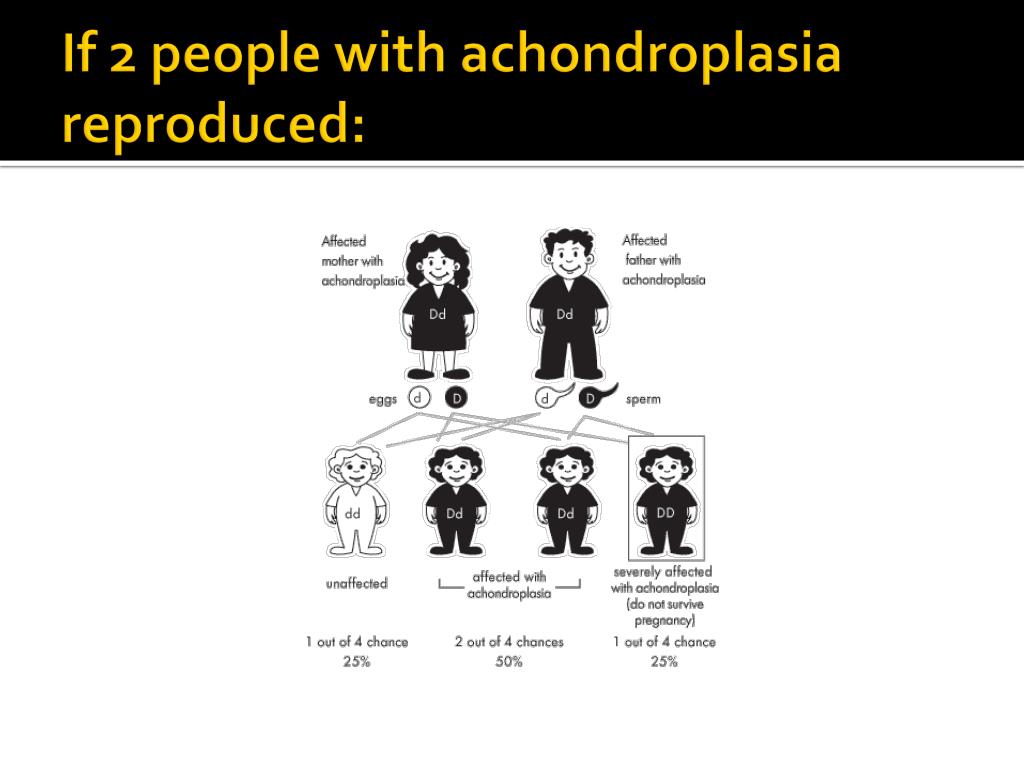 Ppt Achondroplasia Powerpoint Presentation Free Download Id 6134860