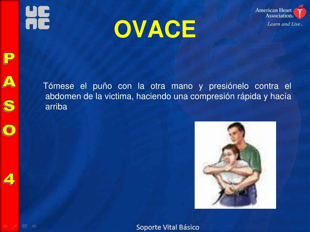 PPT - OVACE OBSTRUCCIÓN DE LA VÍA AÉREA POR CUERPO EXTRAÑO PowerPoint ...