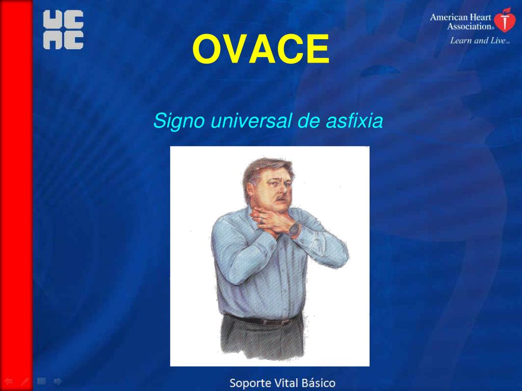 PPT - OVACE OBSTRUCCIÓN DE LA VÍA AÉREA POR CUERPO EXTRAÑO PowerPoint ...