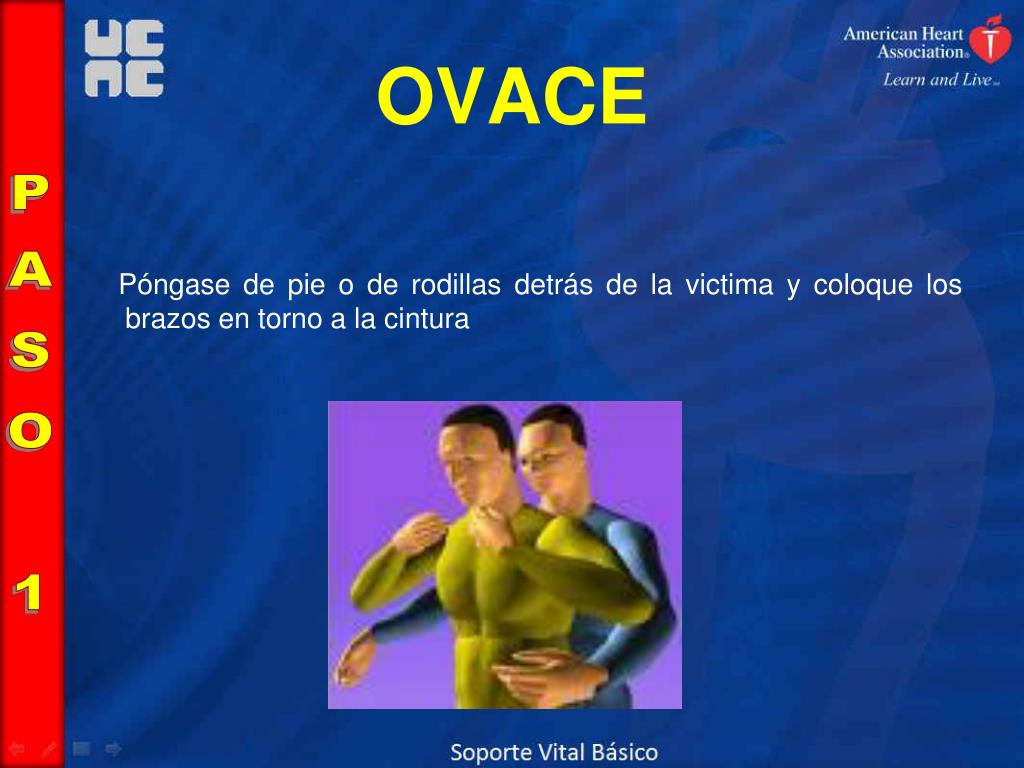 PPT - OVACE OBSTRUCCIÓN DE LA VÍA AÉREA POR CUERPO EXTRAÑO PowerPoint ...