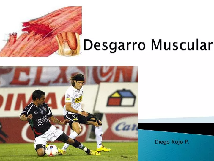 PPT - “ Desgarro Muscular ” PowerPoint Presentation, free download - ID ...