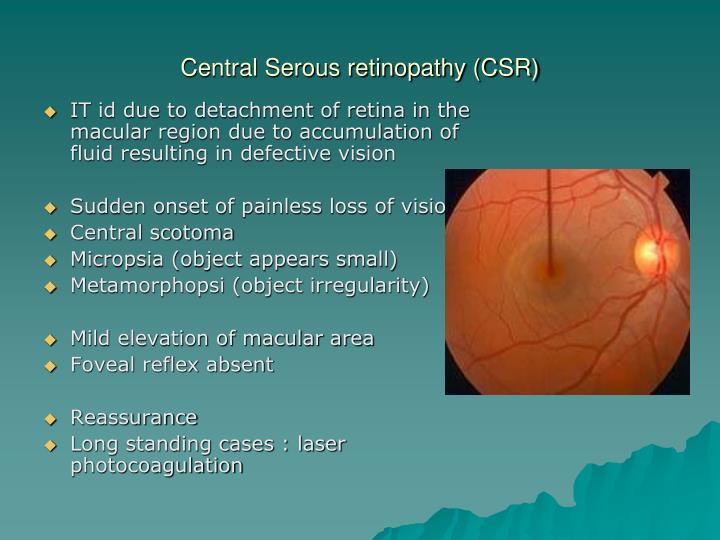 PPT - Retina and Vitreous PowerPoint Presentation - ID:6160709