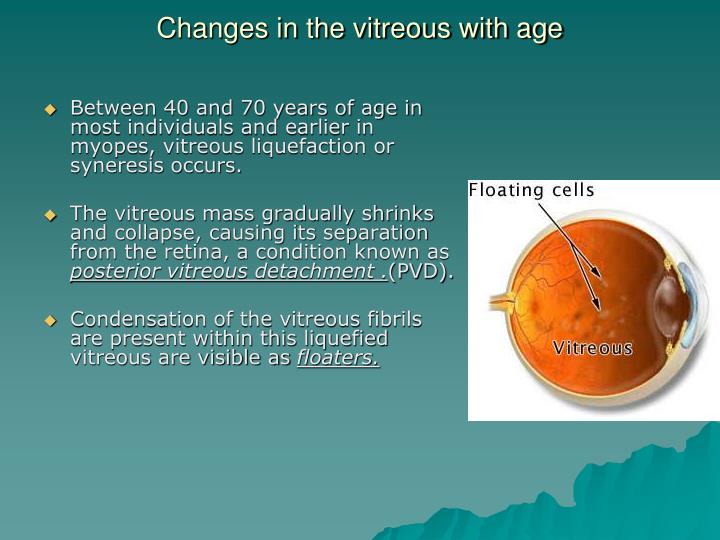 PPT - Retina and Vitreous PowerPoint Presentation - ID:6160709