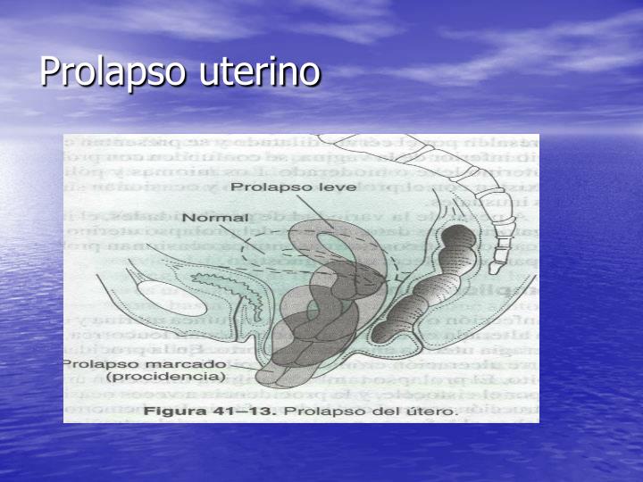 PPT - RELAJACION DEL PISO PELVICO PowerPoint Presentation - ID:6163043