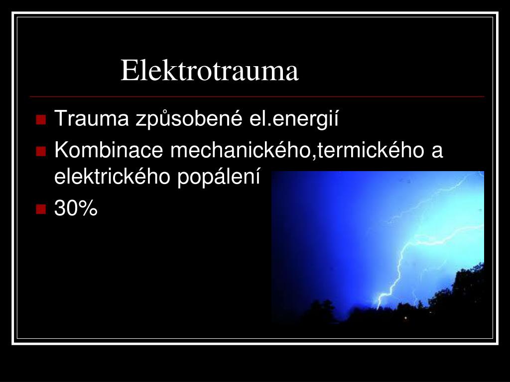 PPT - Zásah elektrickým proudem PowerPoint Presentation, free download ...