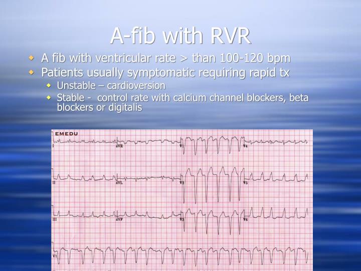 PPT - Cardiac Arrhythmias PowerPoint Presentation - ID:6165641