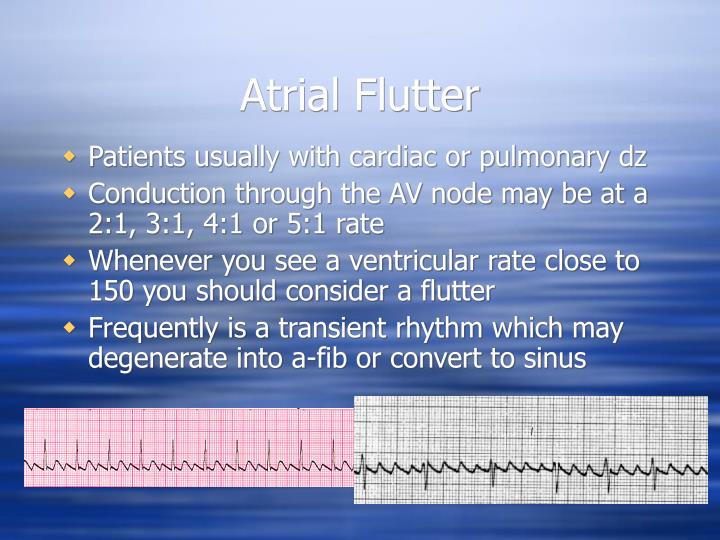 PPT - Cardiac Arrhythmias PowerPoint Presentation - ID:6165641