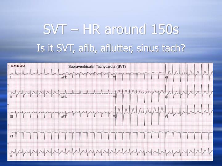 PPT - Cardiac Arrhythmias PowerPoint Presentation - ID:6165641