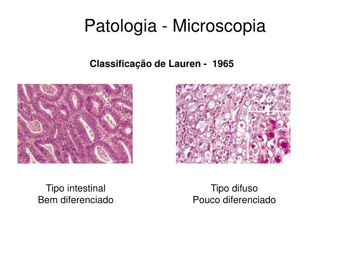 PPT - CÂNCER GÁSTRICO PowerPoint Presentation - ID:6167953