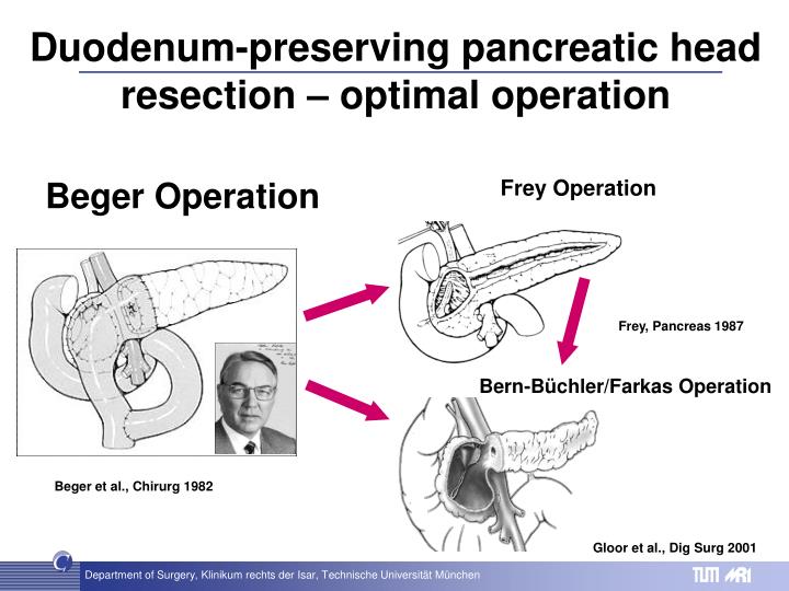 PPT - Endoscopical and/or surgical therapy of chronic pancreatitis ...