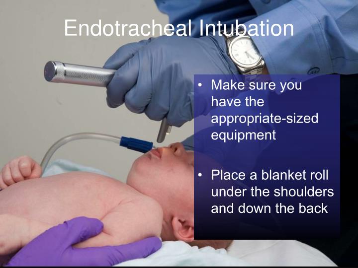 PPT - Neonatology PowerPoint Presentation - ID:6169193