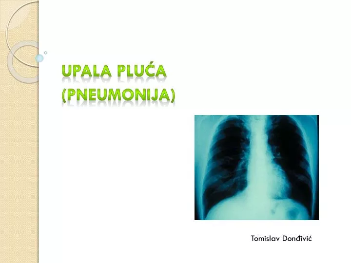 PPT - Upala pluća (pneumonija) PowerPoint Presentation, free download ...