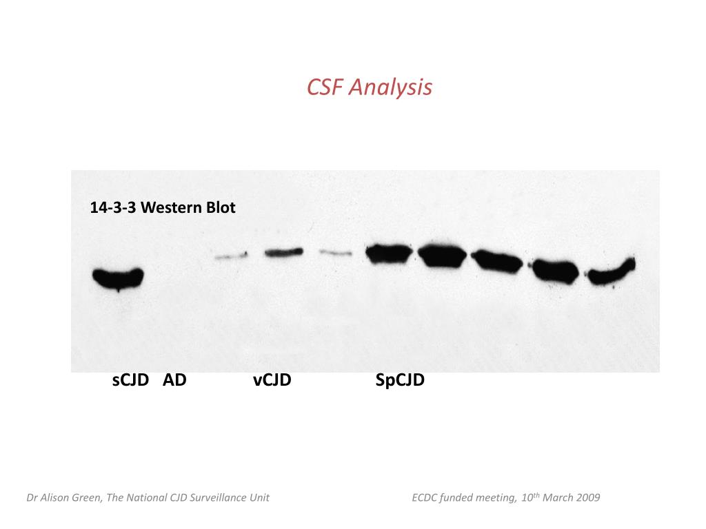 PPT - CJD Overview Bob Will, National CJD Surveillance Unit, Edinburgh ...
