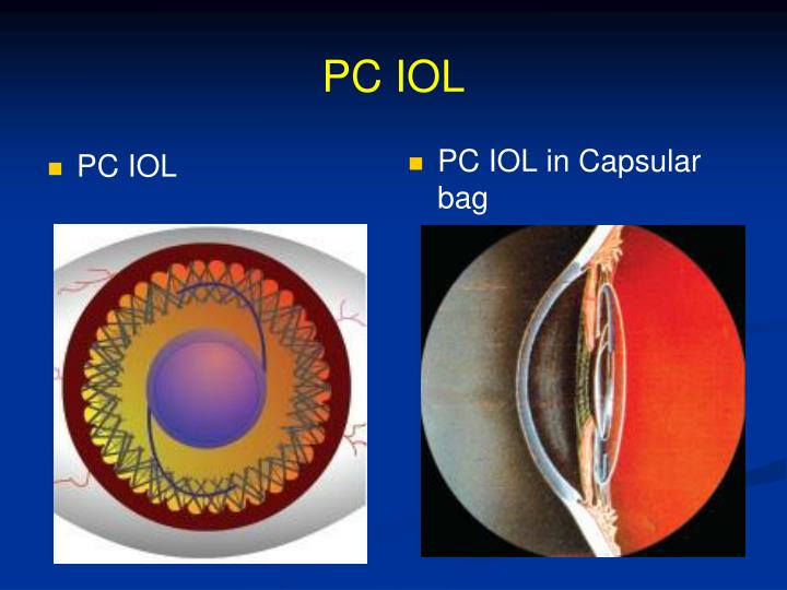 PPT - PROBLEMS OF APHAKIA & IOL PowerPoint Presentation - ID:6184077