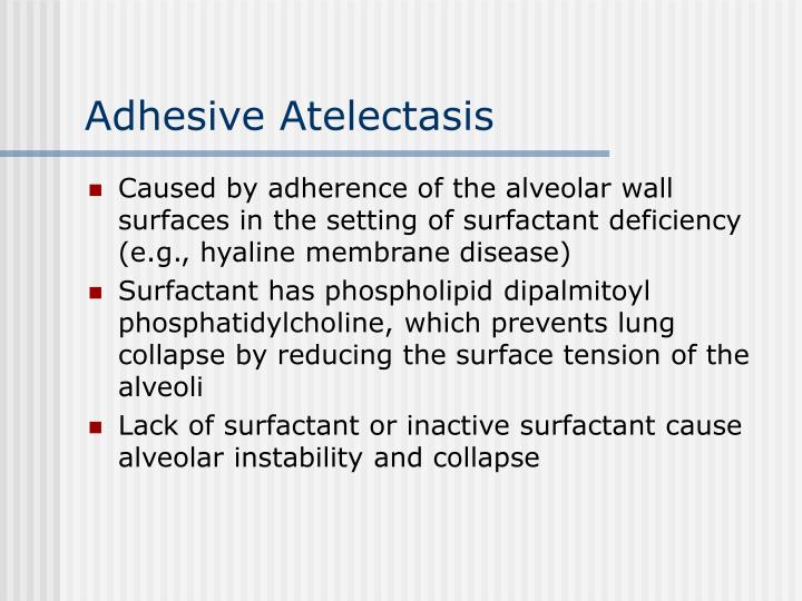 PPT - Atelectasis PowerPoint Presentation - ID:6185976