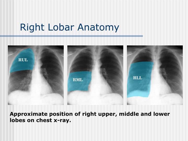 PPT - Atelectasis PowerPoint Presentation - ID:6185976
