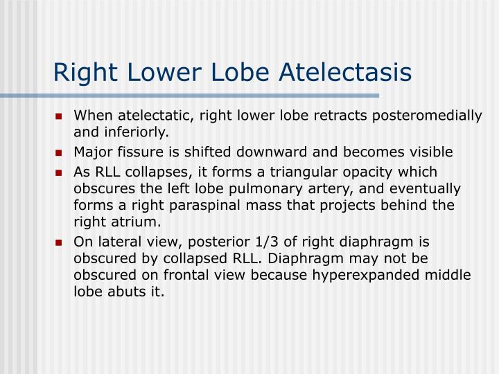 PPT - Atelectasis PowerPoint Presentation - ID:6185976