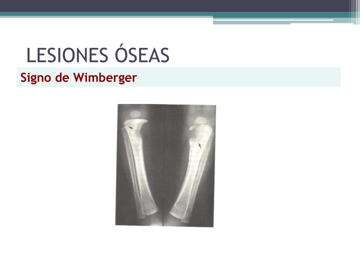 PPT - SIFILIS CONGENITA PowerPoint Presentation - ID:6190309