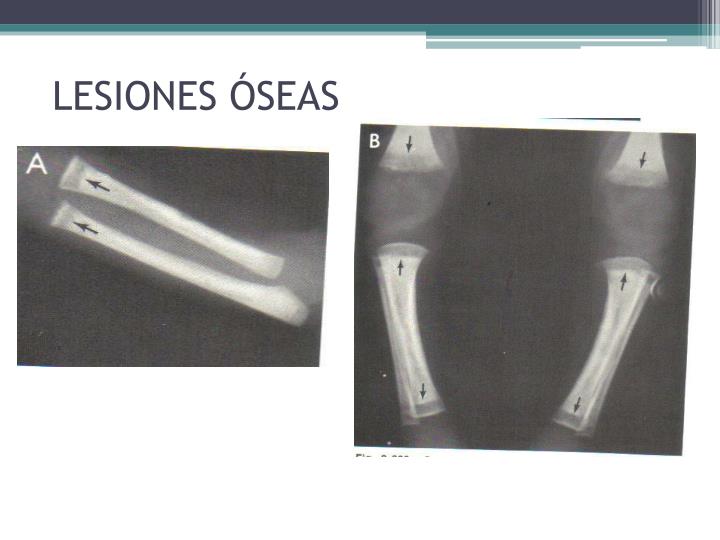 PPT - SIFILIS CONGENITA PowerPoint Presentation - ID:6190309