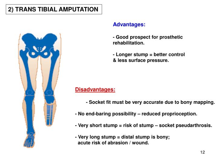 PPT - LOWER LIMB LEVEL AMPUTATION PowerPoint Presentation - ID:6194137
