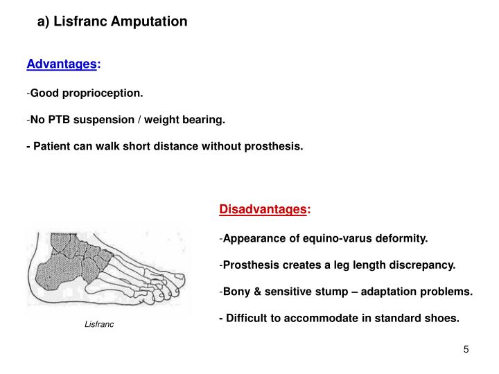 PPT - LOWER LIMB LEVEL AMPUTATION PowerPoint Presentation - ID:6194137