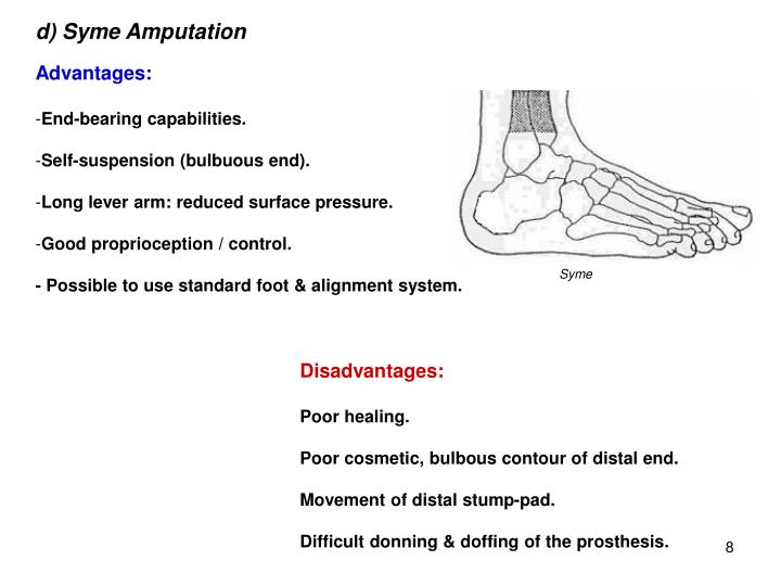 PPT - LOWER LIMB LEVEL AMPUTATION PowerPoint Presentation - ID:6194137
