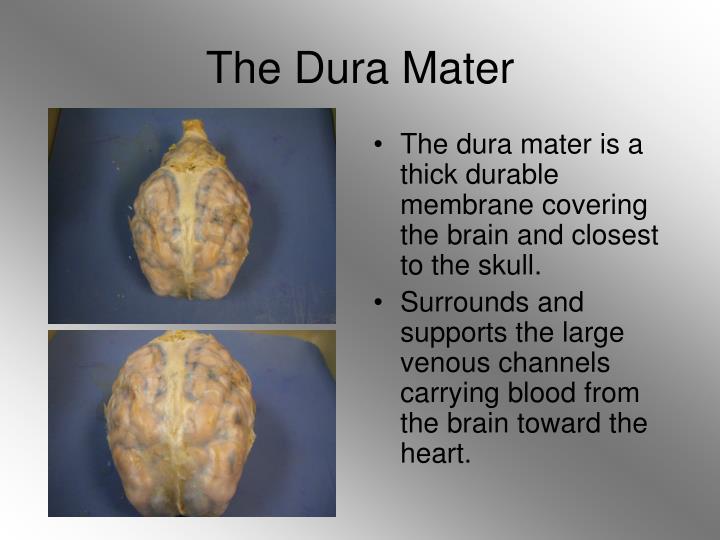 PPT - Sheep Brain Dissection PowerPoint Presentation - ID:6194711