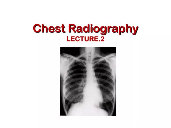 PPT - Chest Radiography LECTURE.2 PowerPoint Presentation, free ...
