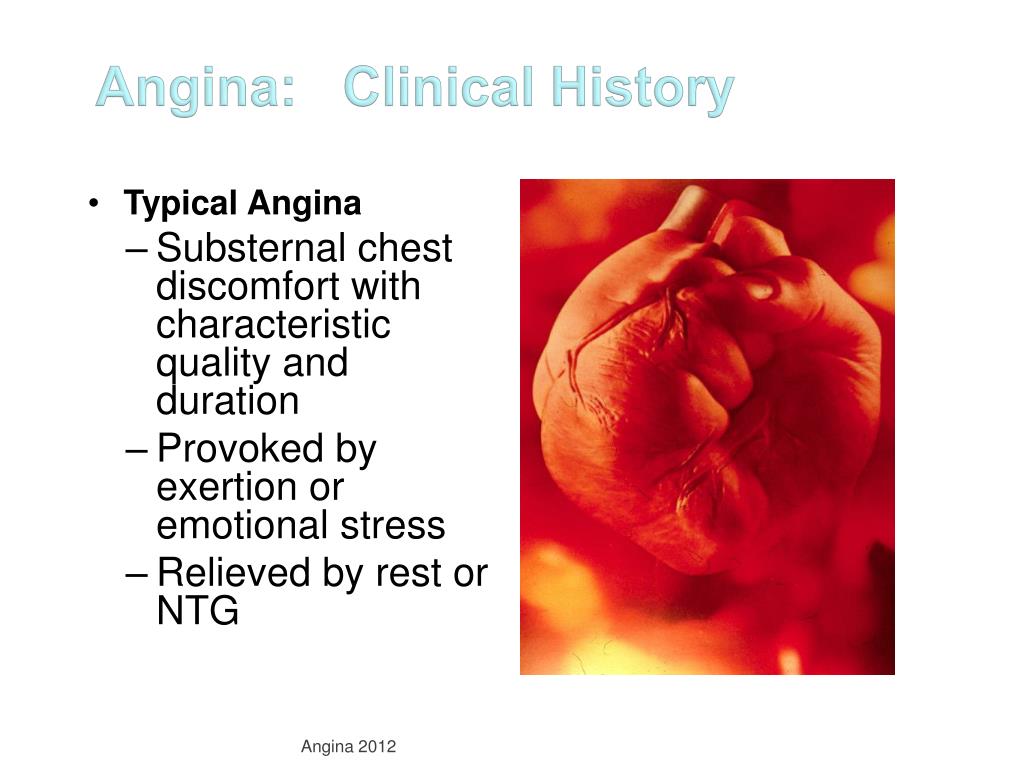PPT - Geriatric Cardiology – You CAN treat Angina! PowerPoint ...