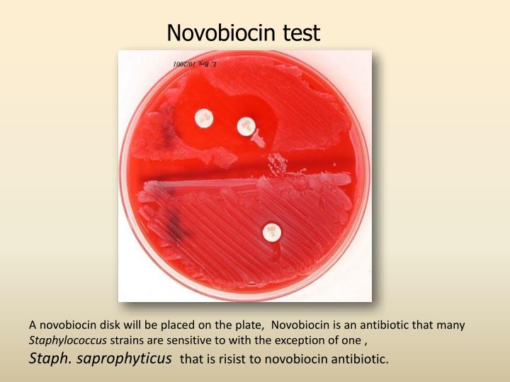 PPT - Isolation and Identification of Staphylococci PowerPoint ...